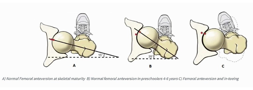 Hindari Tabiat Simpuh Katak - Columbia Asia Hospital I Private Hospital ...