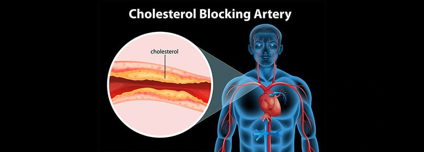 不吃药，胆固醇迫降 - Columbia Asia Hospital I Private Hospital in Malaysia