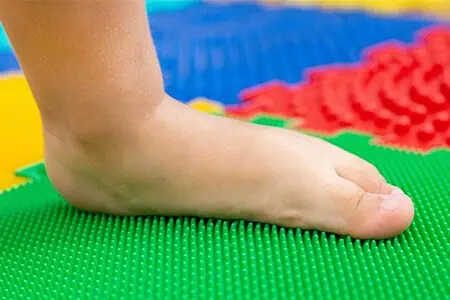 Common Foot Conditions in Kids - Columbia Asia Hospital I Private ...