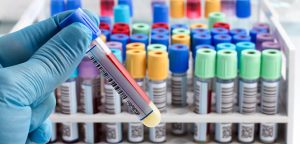 10 Important Blood/Urine Tests - Columbia Asia Hospital I Private ...