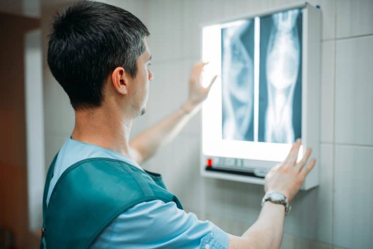 Cancer in your bones may be rare, but it affects people of all ages ...